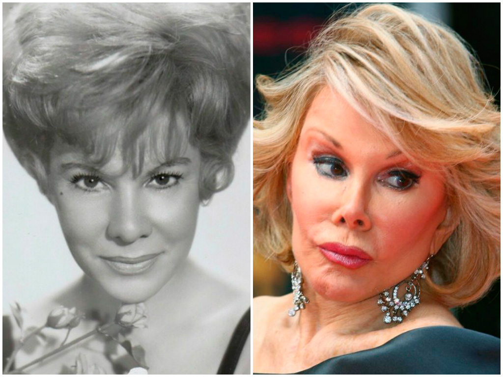 Maria Mónica Urbina y otras famosas deformadas por el botox